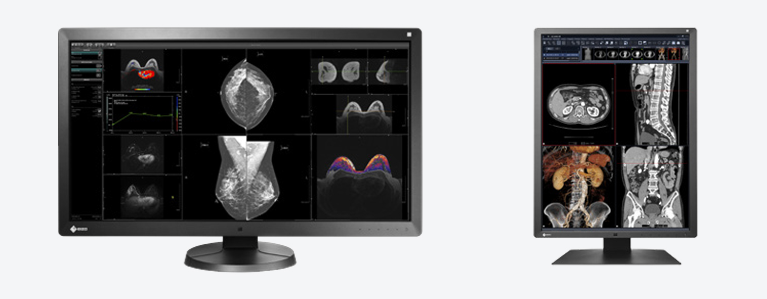 Monitorer - SKAN-RAY - Røntgenudstyr og vedligeholdelse